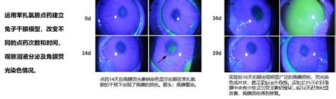 裂隙灯 知乎
