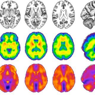 Variable Density Boxplots Pairwise Significant Charts And Sex X Download Scientific Diagram