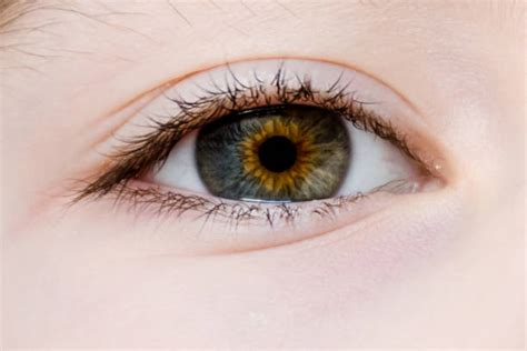 Grey And Brown Heterochromia Understanding Eye Color Variation