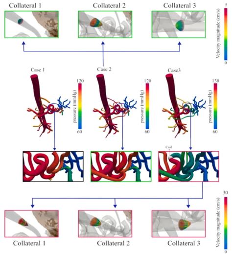 基于医学影像的ai 体外实验 Cfd血流动力学仿真技术服务 仿真分析 二次开发 付费答疑 其他服务 仿真秀