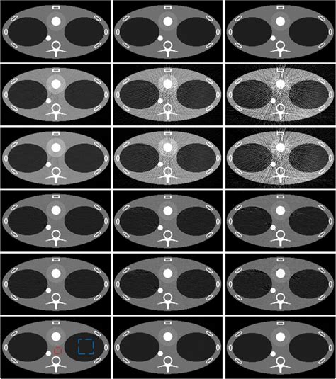 The Reconstruction Results Of The Phantom Columns From Left To Right Download Scientific