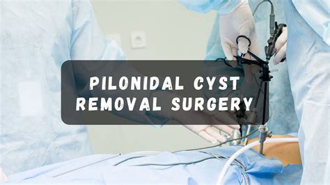 Minimally Invasive Options For Pilonidal Cyst Removal Magazine Valley