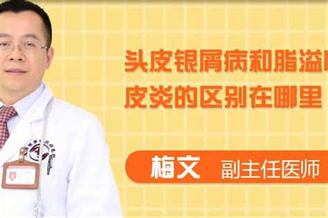 头皮银屑病和脂溢性皮炎的区别在哪里 凤凰网视频 凤凰网