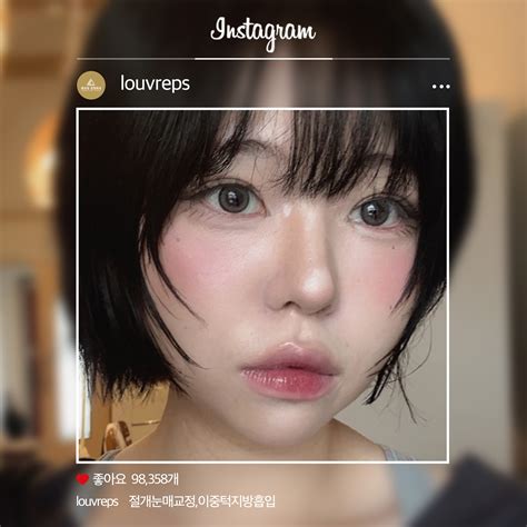 루브르성형외과 처음처럼 자연스럽게 전후사진후기셀카후기