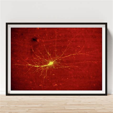 Cerebral Cortex Stellate Neuron Poster By Science Photo Library Science Photo Gallery