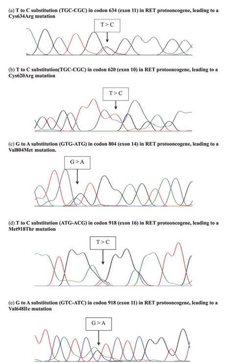 Electropherograms Showing Five Different Types Of Ret Mutations In