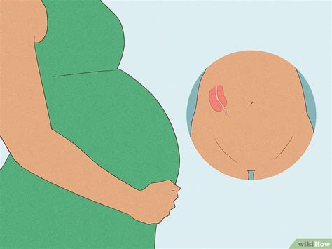 How To Recognize The Symptoms Of Appendicitis 8 Signs