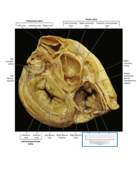 71 Diagram Quizlet
