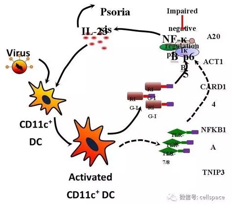 Embo Mol Med 上海交大王宏林课题组报道病毒或为引发银屑病关键因素 搜狐大视野 搜狐新闻