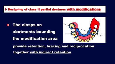 2 B Basic Principles For Designing Kennedy Class Ii Iii And Iv Rpd Copy Pptx