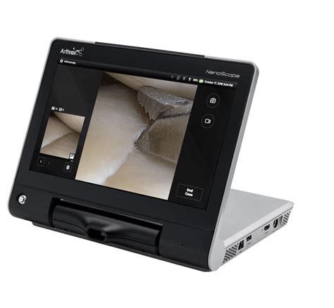 Arthrex Nano Arthroscopy