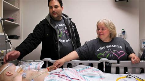 Conjoined Twin Girls Separated By Surgeons At Houston Hospital