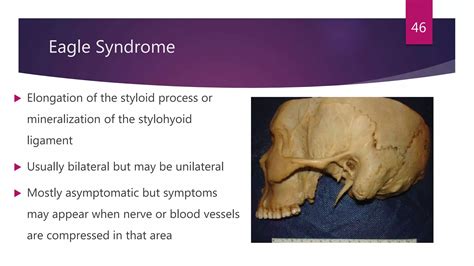 Developmental Defects Of Oral And Maxillofacial Region Pptx Dental