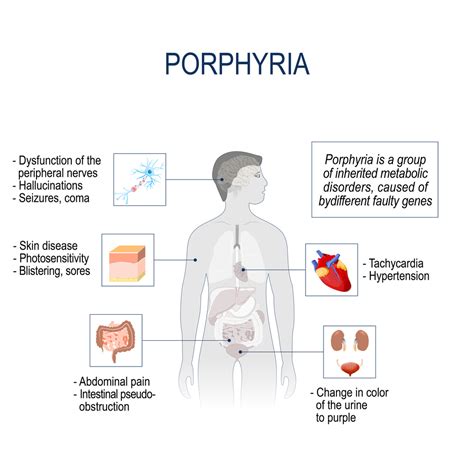 Porphyria Painscale