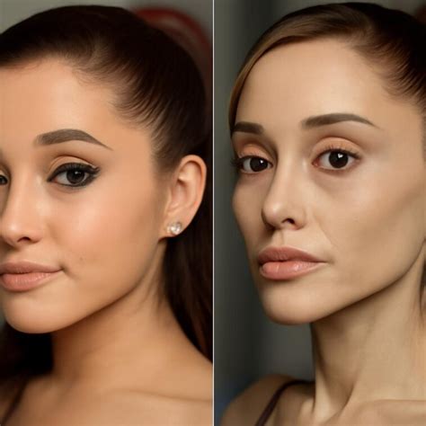 A Transformação Facial De Ariana Grande E O Fenômeno ‘ozempic Face