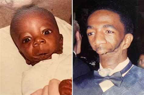 Man Born Without A Jaw Finds Love Sports Hip Hop And Piff The Coli