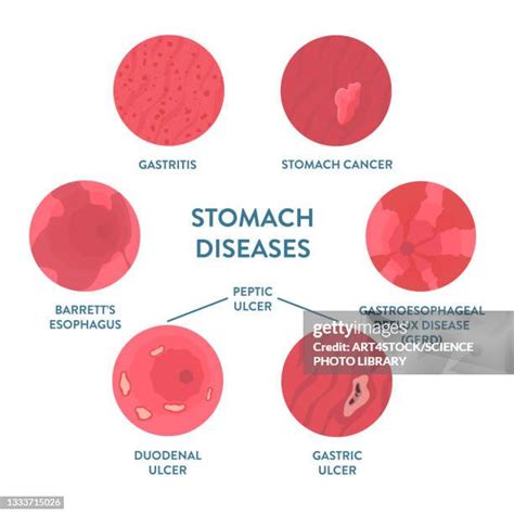Stomach Acid Color