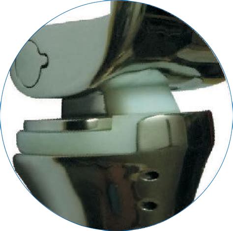 Proximal Tibial Rotating Knee In London Proximal Tibial Rotating Knee Manufacturers Suppliers