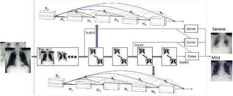 Yolov3 Dense Network For Lung Detection Download Scientific Diagram
