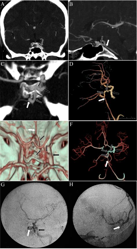Imaging Modalities Used For Illustration Of Primitive Persistent Download Scientific Diagram