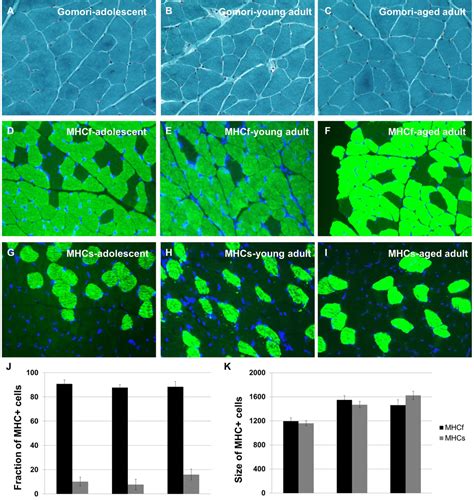 Naked Mole Rats Maintain Healthy Skeletal Muscle And Complex IV