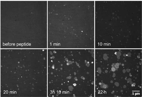 Time Course Of Supported Lipid Bilayer Perturbation By Wild Type Ll 37 Download Scientific