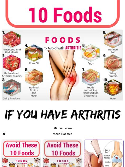 Do You Know About Rheumatoid Arthritis And Its Signs And Symptoms How