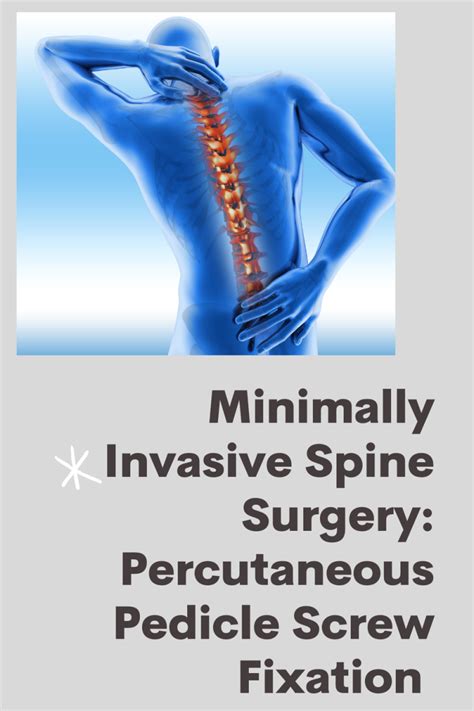 Minimally Invasive Spine Surgery Percutaneous Pedicle Screw Fixation Sbb