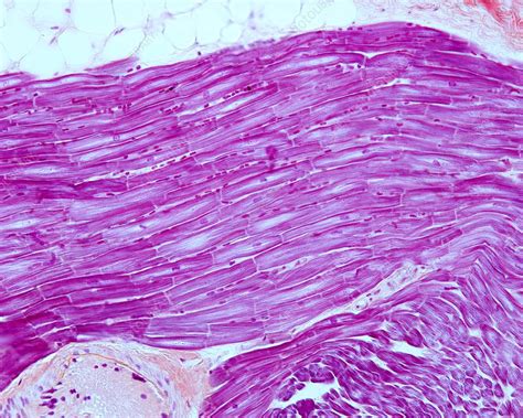 Heart Histology Atrium Human Heart Endocardium Stock Image Image Of
