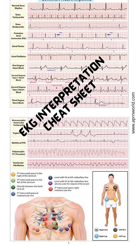 Cardiac Rhythm Cheat Sheet