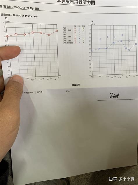 纯音听力和耳声发射检查 知乎