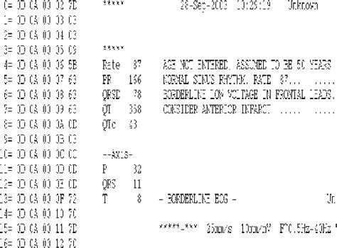 Scp Ecg Semantic Scholar