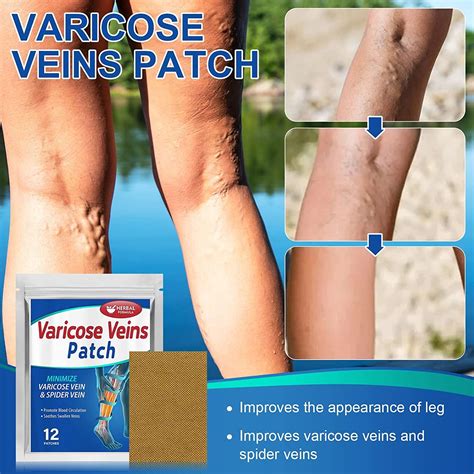 Varicose Veins Treatment Patch 12 Pcs For Spider Veins Leg Pain