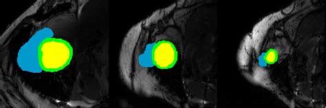 2 Sample Images From The 3 Datasets With Ground Truth Regions Download Scientific Diagram