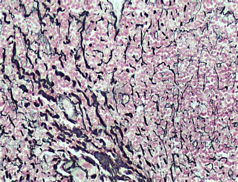 Reticulin Nuclear Fast Red Stain Kit Histopathology At Rs 12320 Kit In Hyderabad