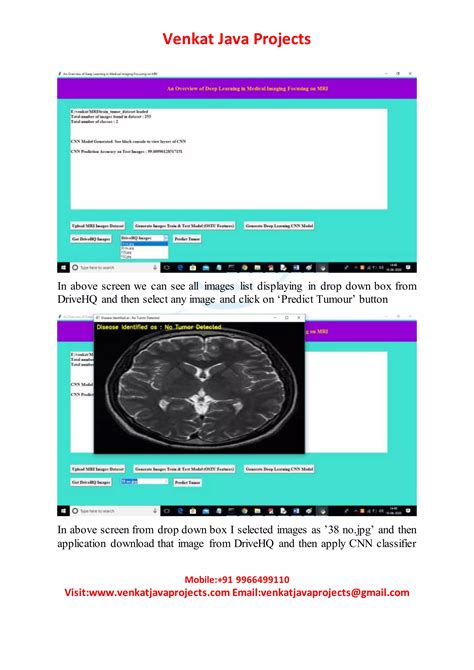 An Overview Of Deep Learning In Medical Imaging Focusing On Mri Screenshots Docx Artificial
