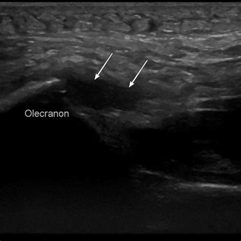 Preoperative Ultrasound Diagnostic Download Scientific Diagram