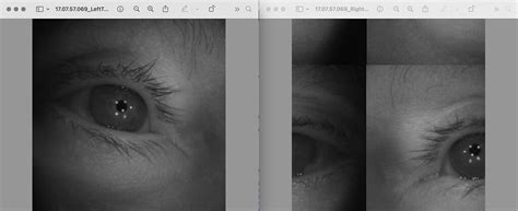 pupil tracking lost unity development magic leap 2 developer forums