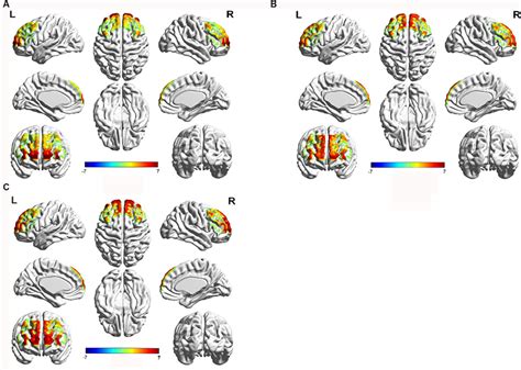 Brain Activation Map Of The Frontal Cortex During Immediate Recall Task Download Scientific
