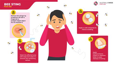 Bee Bite How To Treat A Bee Sting University Health News