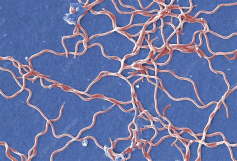 Borrelia Burgdorferi Bacteria Coloured Sem Stock Image C0600043