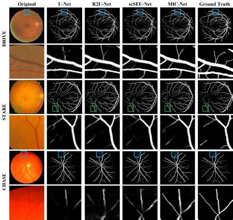 Comparative Results Of The Sota Methods And Our Proposed Mic Net On Download Scientific Diagram