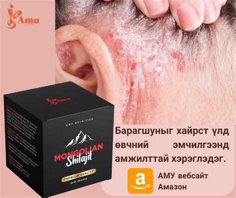 Amu Usa БАРАГШУН НЬ МАШ ОЛОН ӨВЧНИЙ ЭМЧИЛГЭЭНД Facebook