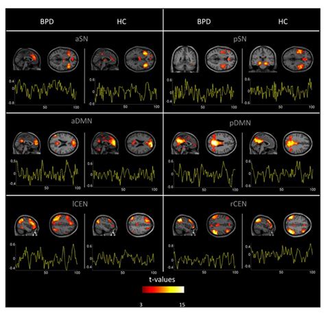 Spatial Maps And Time Courses Of Default Mode Salience And Central Download Scientific