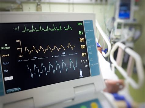 Interpreting Critical Vital Signs Canadiem
