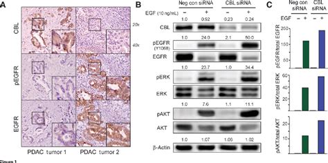 Figure 1 From Low Expression Of The E3 Ubiquitin Ligase Cbl Confers