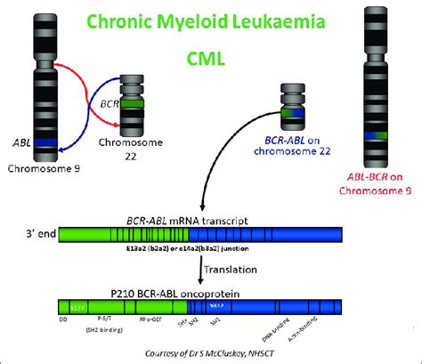 The Bcr Abl 1 Reciprocal Translocation Of Chromosomes 9 And 22 In Download Scientific Diagram