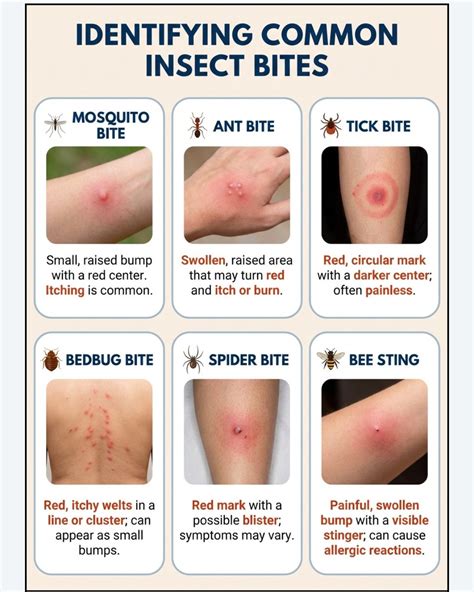 Easy Identifying Common Insect Bites Can Help You Stay Safe Insect