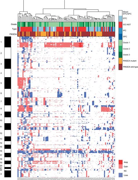 Unsupervised Hierarchical Clustering Analysis Of Papillary Carcinomas