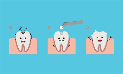 Dental Step Of Restoring Cavity Tooth By Filling Tooth Illustration